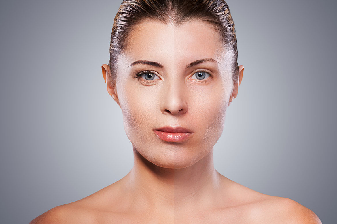Wrinkle Smoothing - Elite Body Contouring in Northern Virginia | Ultra ...