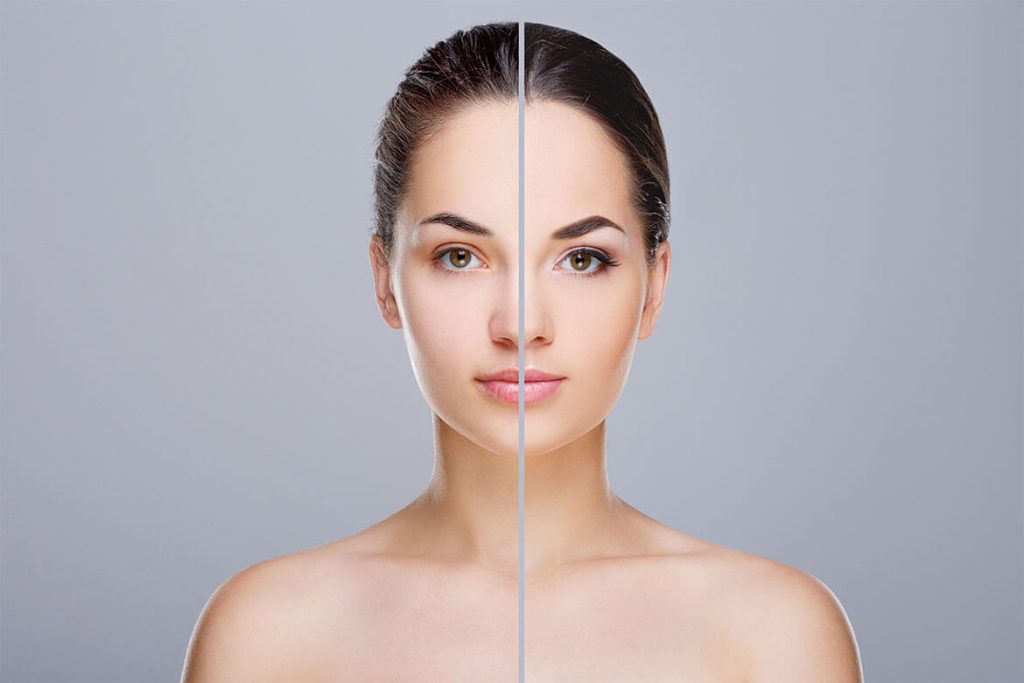 Forehead Correction - Elite Body Contouring in Northern Virginia ...