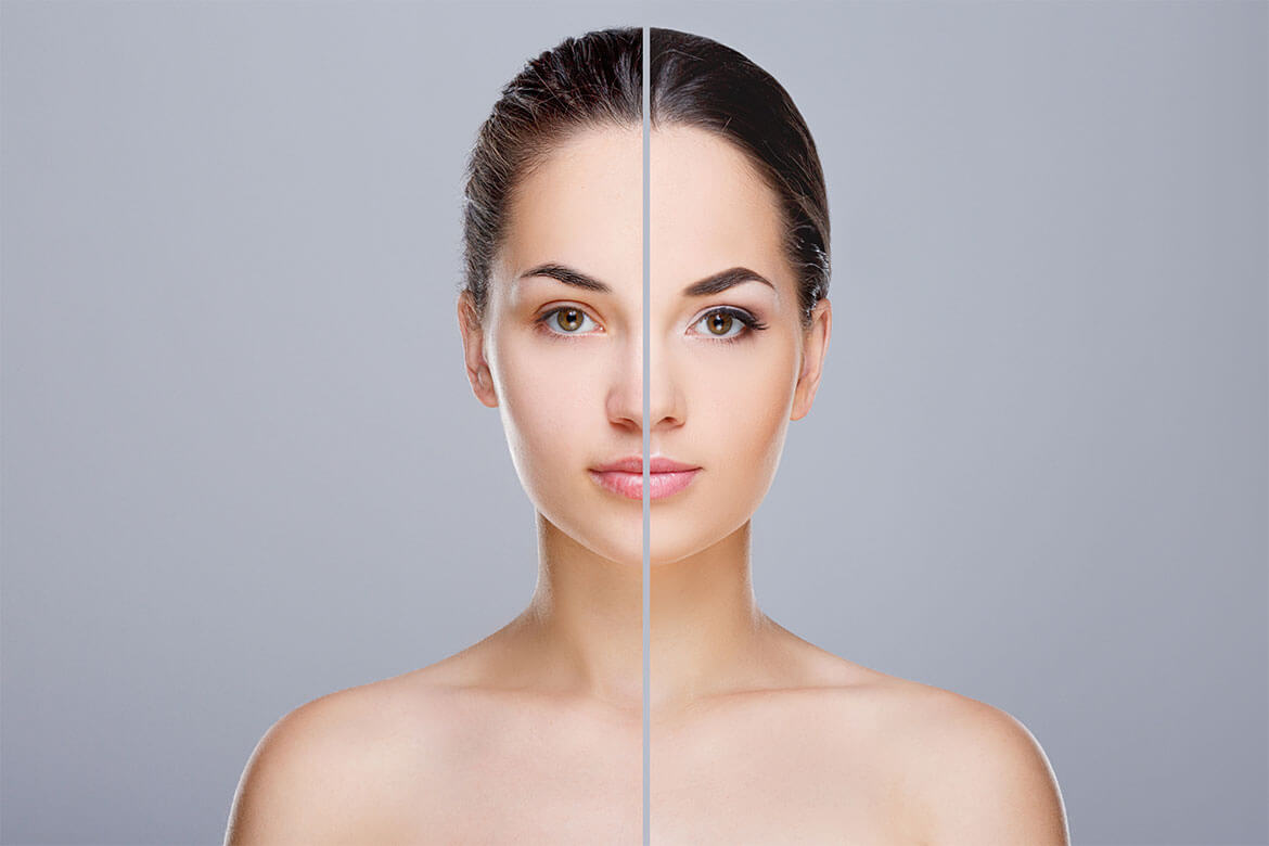 Wrinkle Smoothing - Elite Body Contouring in Northern Virginia | Ultra ...