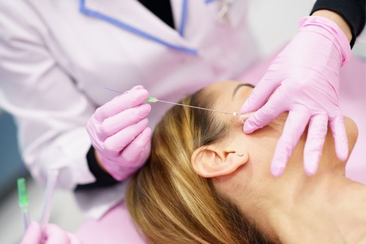 Thread Lift in Arlington | Best Facial Rejuvenation in VA | Ultra Body ...