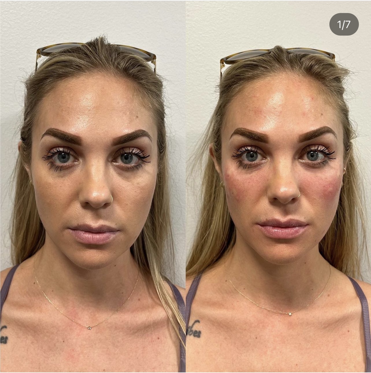 Anti-Aging - Elite Body Contouring in Northern Virginia | Ultra Body Sculpt