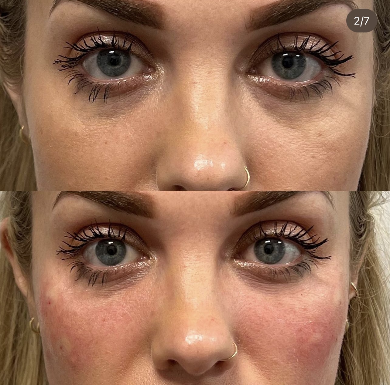 Anti-Aging - Elite Body Contouring in Northern Virginia | Ultra Body Sculpt
