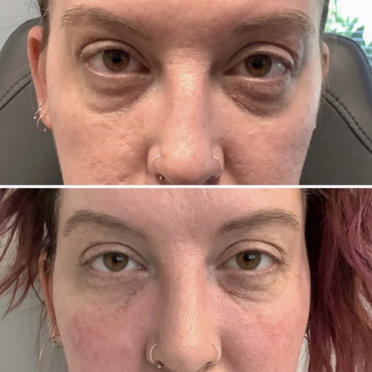 Anti-Aging - Elite Body Contouring in Northern Virginia | Ultra Body Sculpt