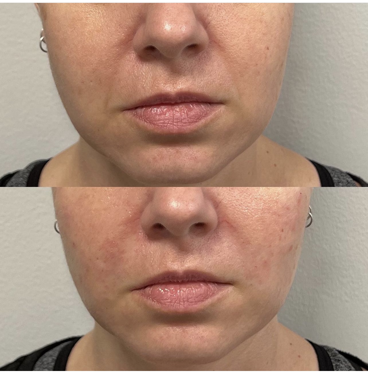 Anti-Aging - Elite Body Contouring in Northern Virginia | Ultra Body Sculpt