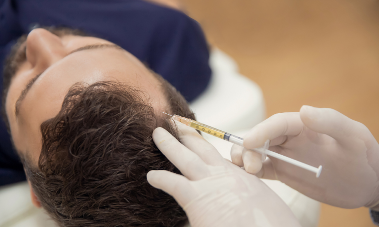 Prp Vs Prf For Hair Loss Which Treatment Delivers The Best Results